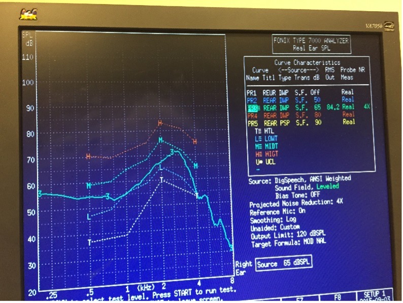Real Ear Measurements - Hearing Aid Fittings | Potomac Audiology